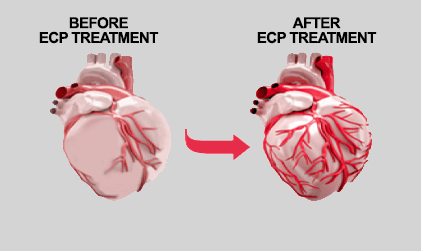 Cardiologist in Mumbai | Best Heart Speacialist in Mumbai- IPC Heart center